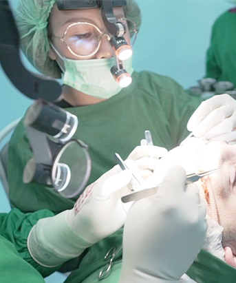 Hair Transplant atau Cangkok Rambut Mengatasi Kebotakan