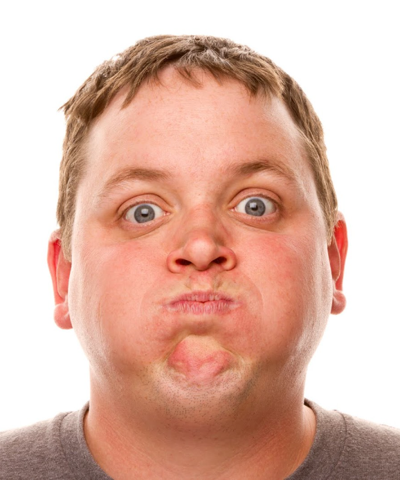 cara menghilangkan pipi chubby bersama dokter spesialis dengan treatmen ...